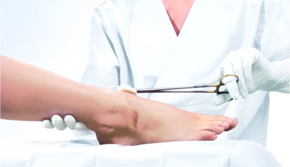 A new approach to leg ulcer management