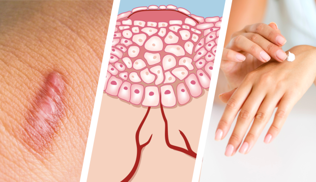 Skin Integrity in Practice