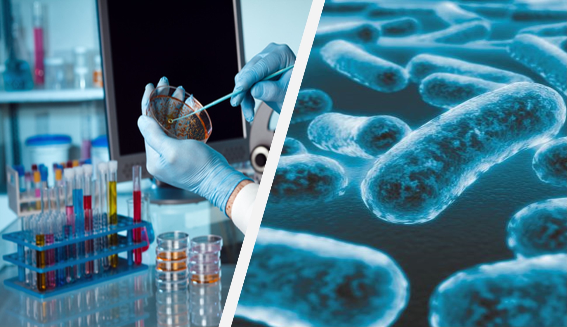 Understanding Gram-negative Infections